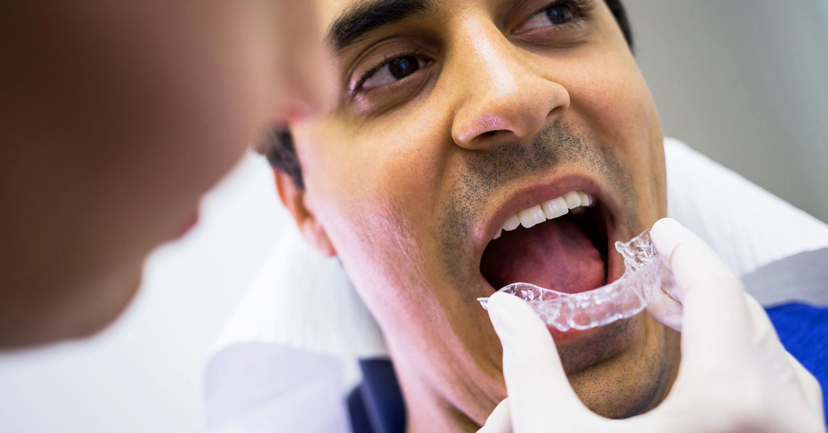 Insights on Invisalign®